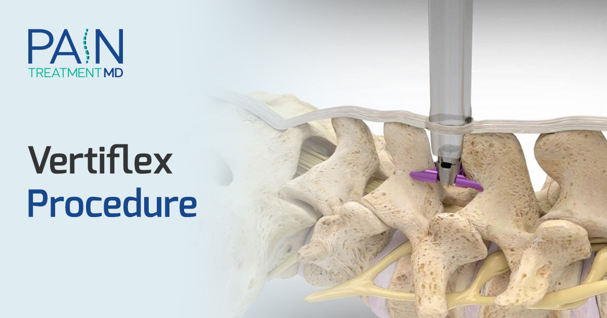 Pain Treatment MD - Vertiflex Procedure in Arkansas