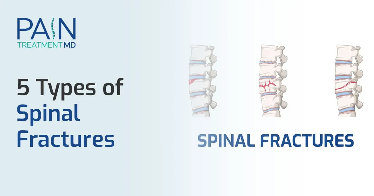 10 Types of Spinal Fractures