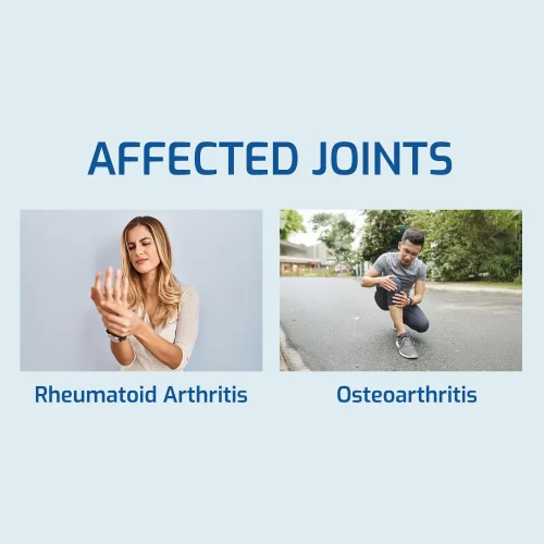 Osteoarthritis vs Rheumatoid Arthritis: What's The Difference